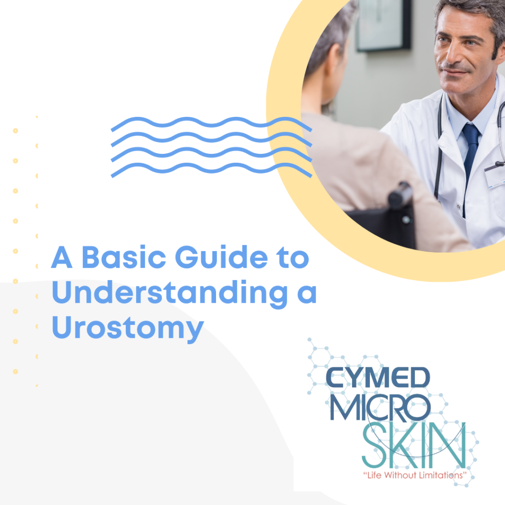 Basic Guide to Understanding Urostomy | Durable Ostomy Pouches
