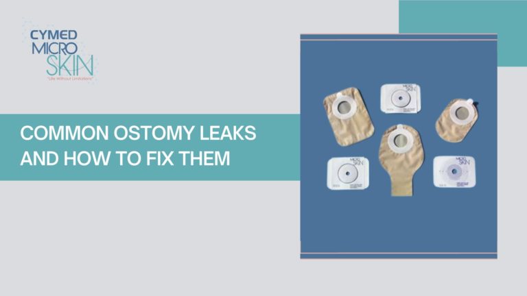 Ostomy Accessories and Pouches | Managing Common Pouch Leaks